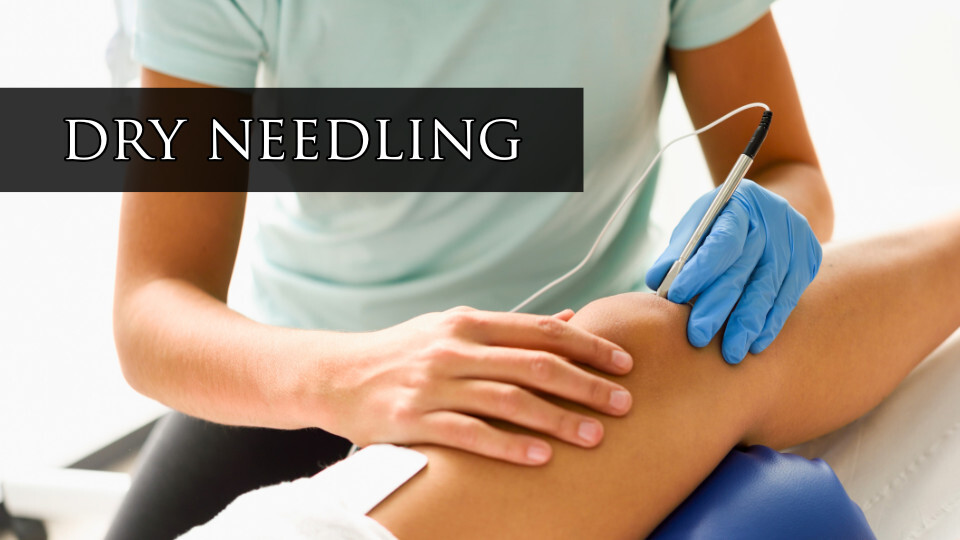 Why Dry Needling Might Be the Key to Finally Releasing Your Chronic ...